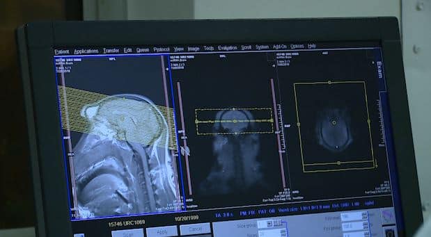 Baboon Brain Scans - TXBioBytes Podcast - Texas Biomed