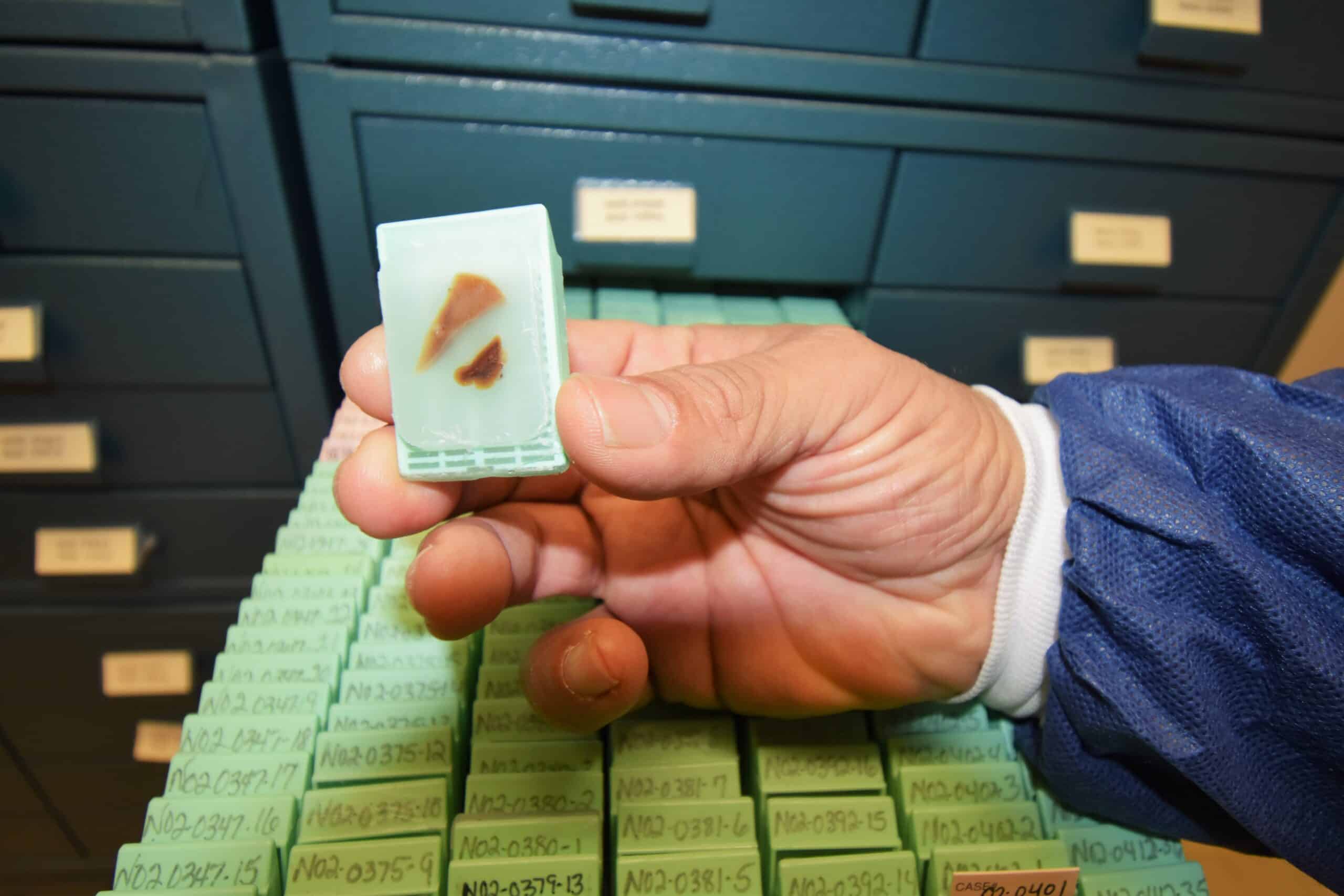 TX BioBytes - Tissue Bank Deposits Generate Interest