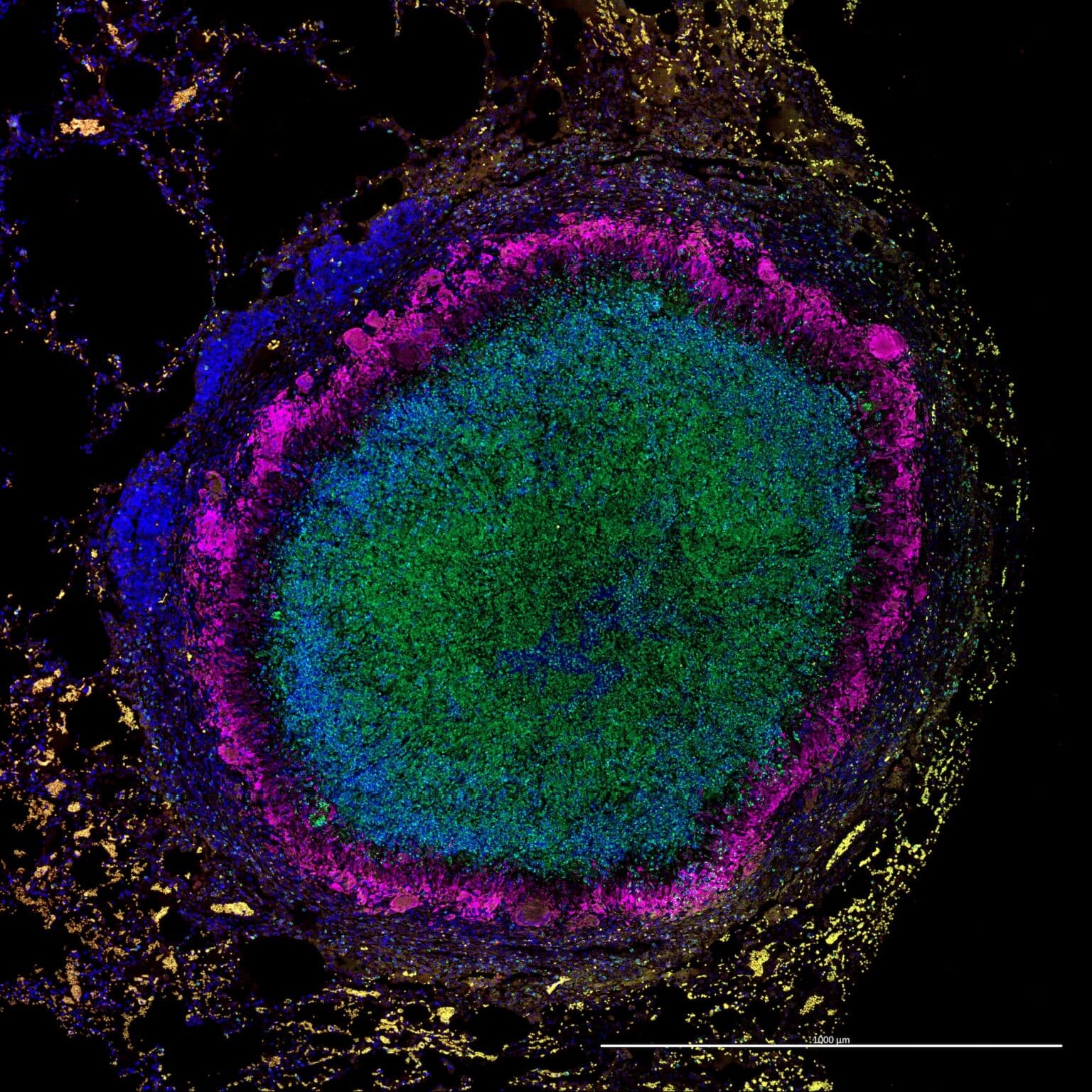 Therapy shows promise to help clear tuberculosis - Texas Biomed