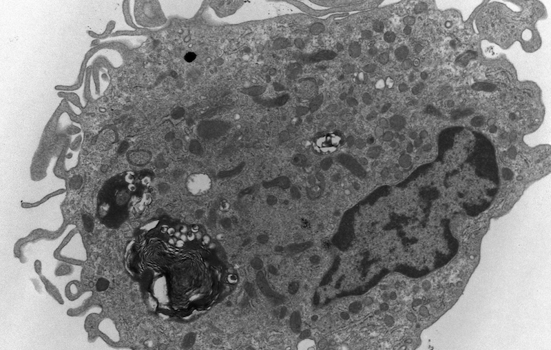 Human cell model developed at Texas Biomed helps fuel discovery - Texas ...